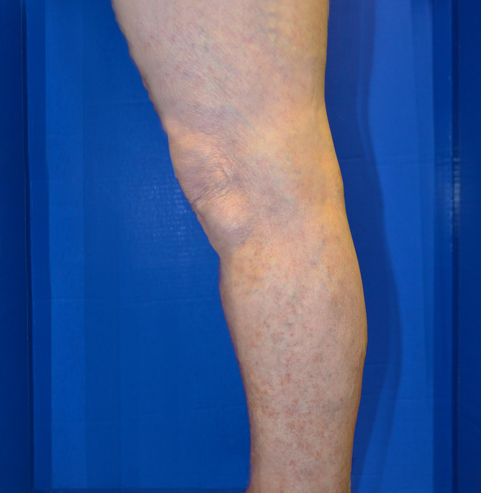 Home - New York Vein Treatment Center