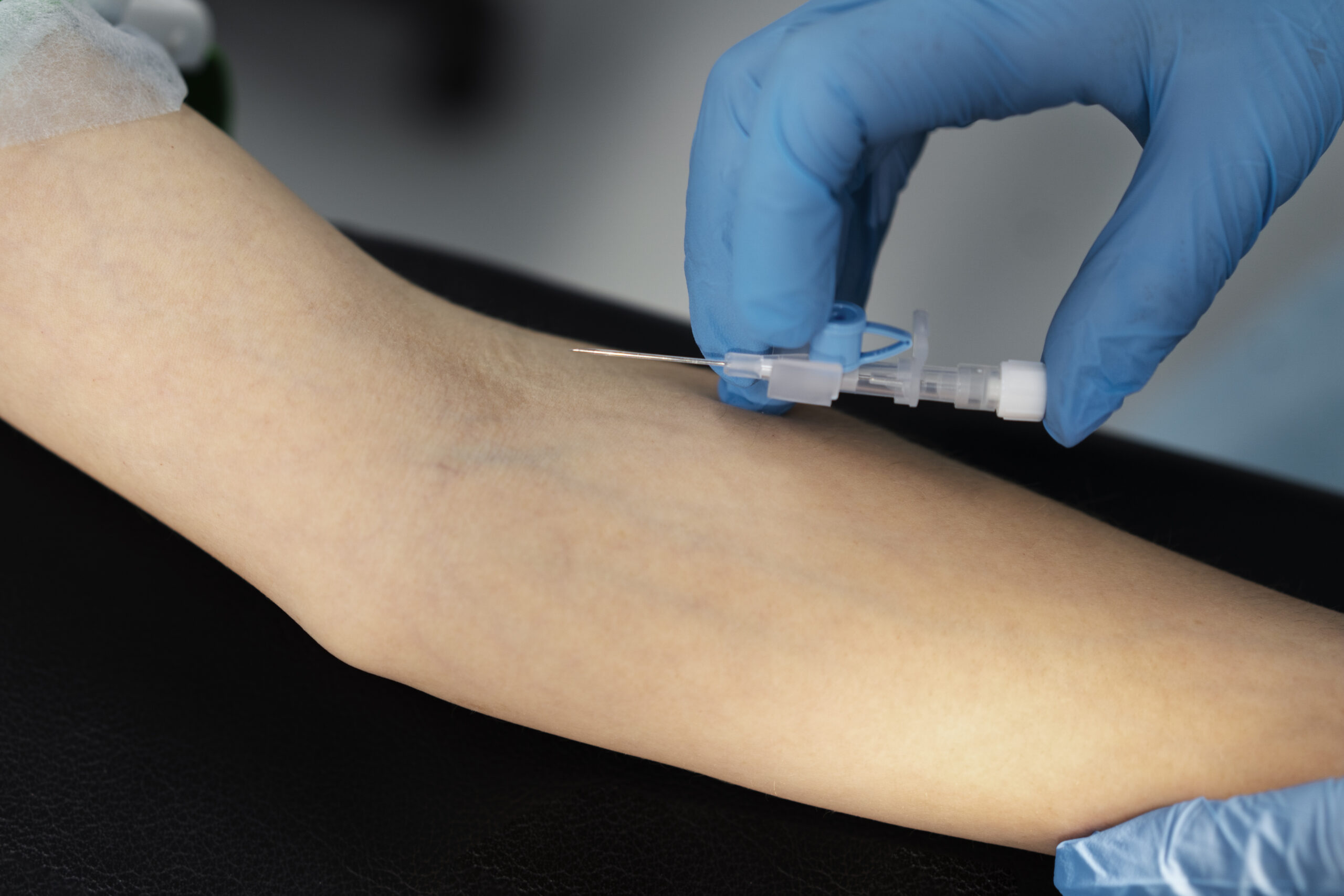 Therapies Found at the NY Vein Treatment Center